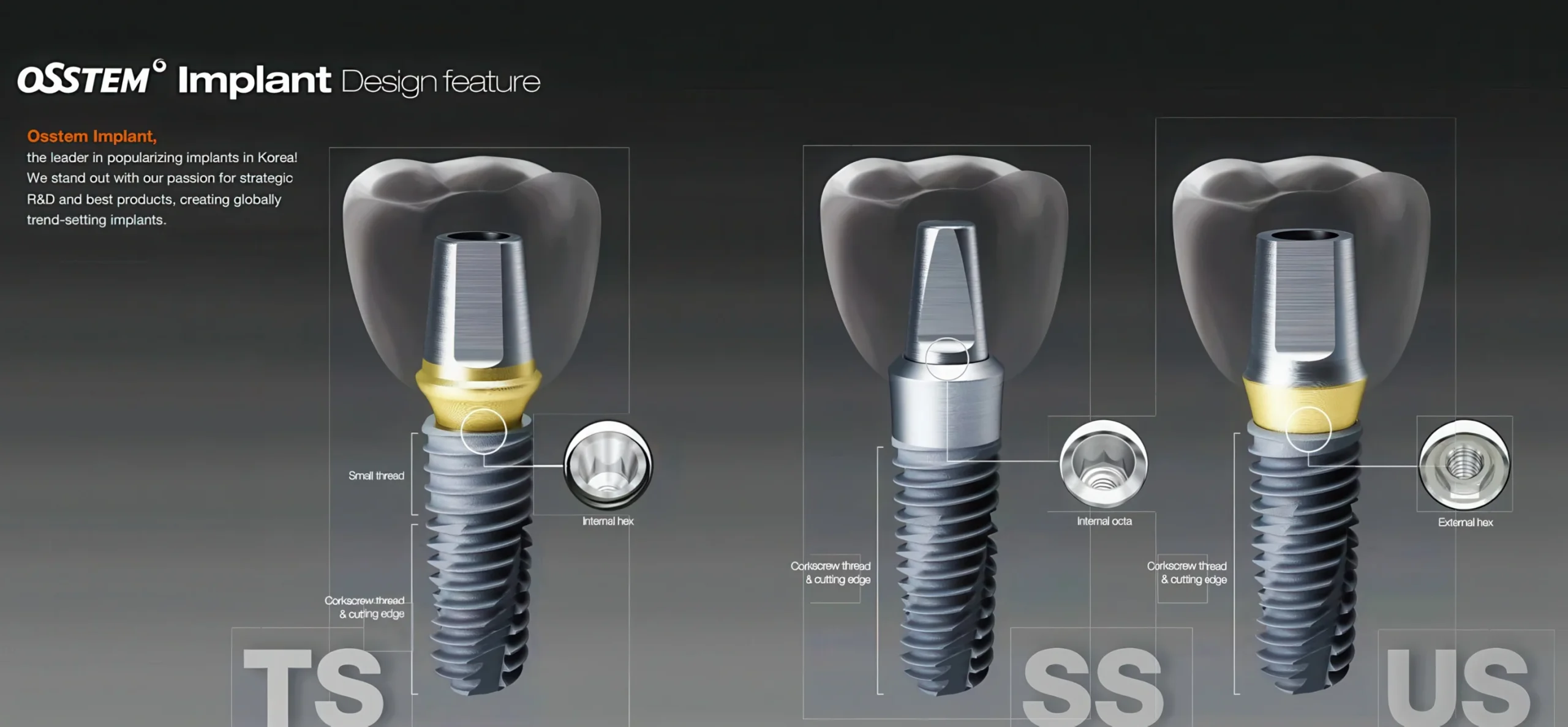 Импланты Osstem – корейское качество и долговечность по доступной цене | Имплантация зубов в ...