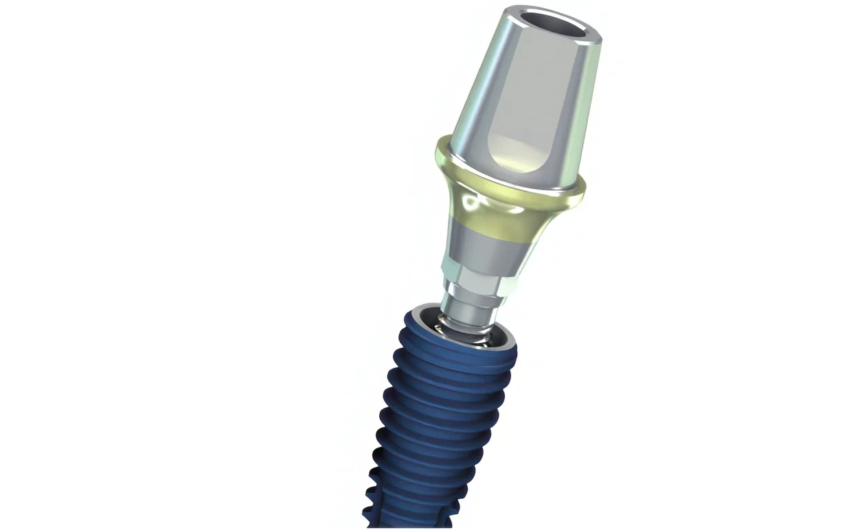 Импланты AnyOne: преимущества, особенности, детали.